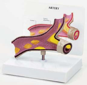 Artery Model | Sience Supplies | Item # 14024